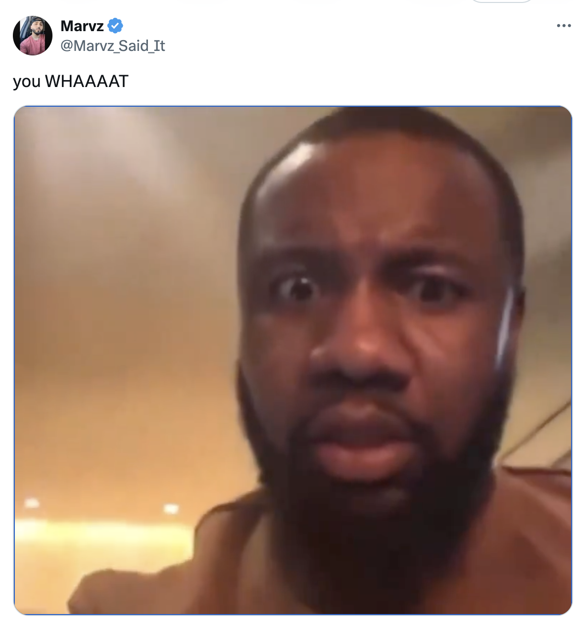 Cardi B Shocks Fans With New Piercing In Unbelievable Spot